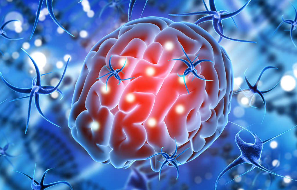 Best Peripheral Neuropathy Treatment Cincinnati Ohio